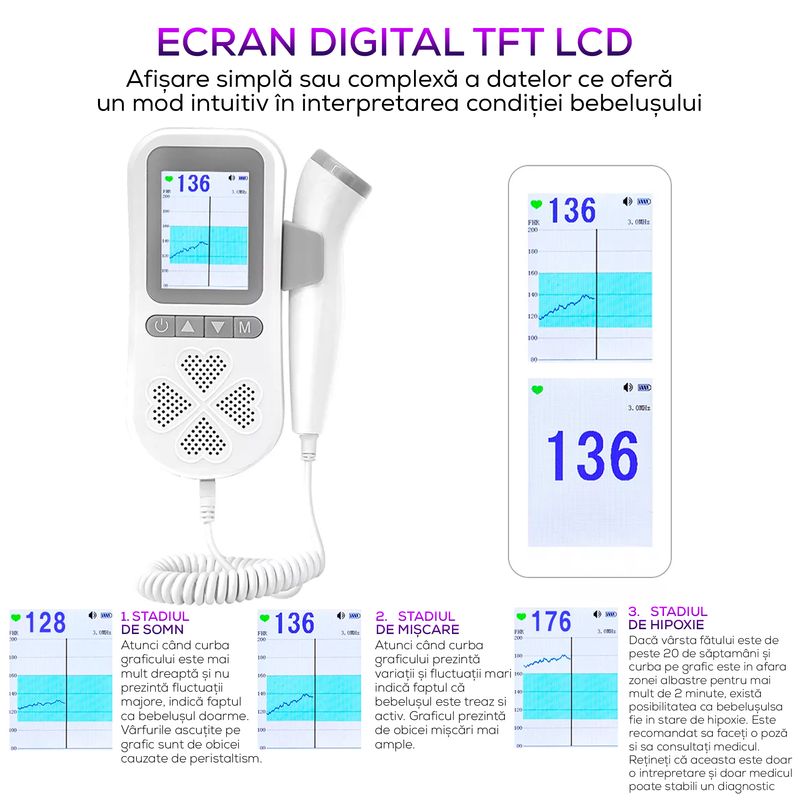 Monitor Fetal Doppler Pentru Gravide, Vixev, Gel Inclus, Alb/Gri ...